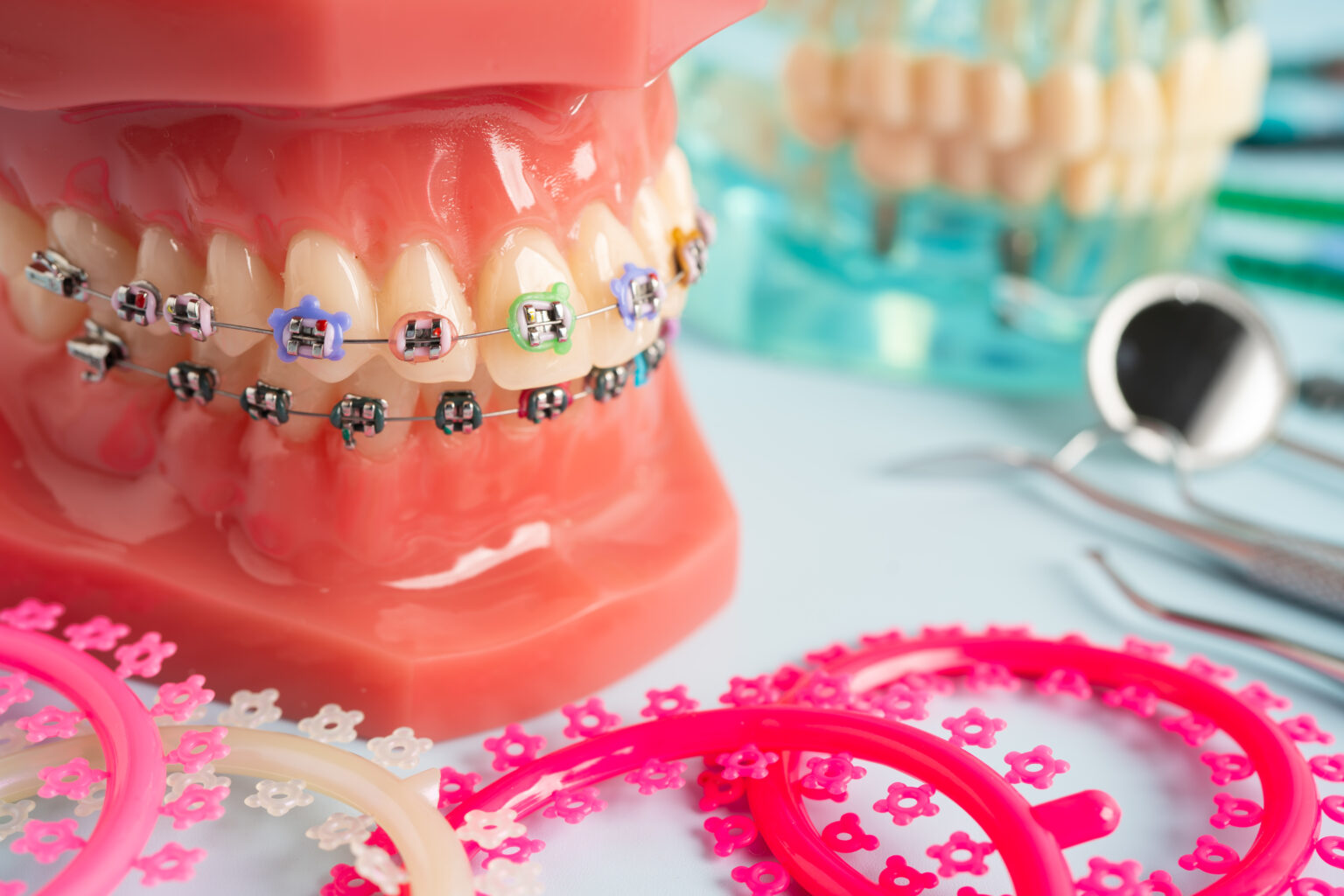 How Do Braces Work? A Step-by-Step Orthodontic Guide